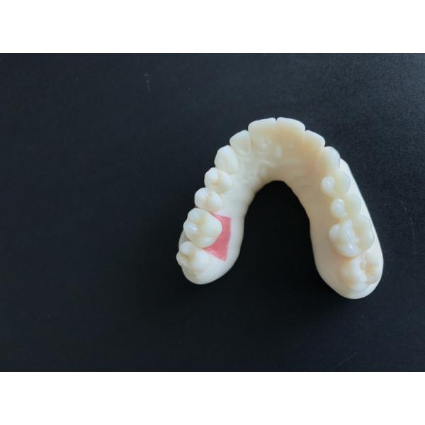 Quality Digital Oral Scanning PFM Dental Crowns Bridge Implantology Demands for sale