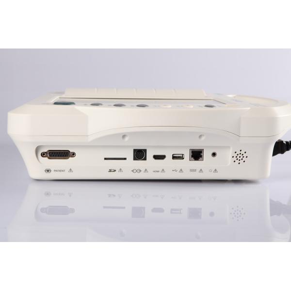 Quality 4.3 Inch 12 Lead ECG Monitor Hospital Rechargeable Li Battery Powered for sale