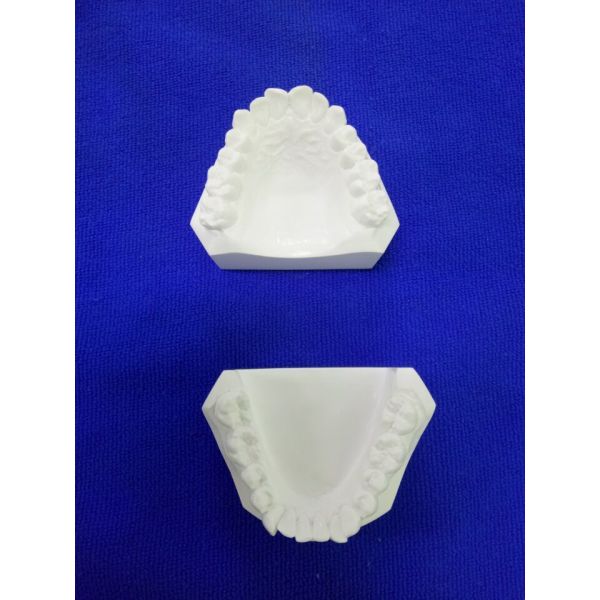 Quality Dental Study Model with CAD CAM Digital Design and 3D Printing Workflow for for sale