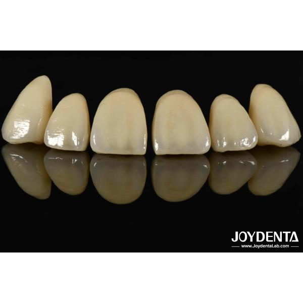 Quality Bionic Development Leaves And Distinct Layers Of Zirconia All-Ceramic for sale