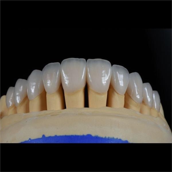Quality Dental Lab Teeth Feldspathic Porcelain Veneers Custom Shaped for sale