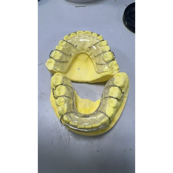 Quality Custom Molded Hawley Retainer with Adjustable Wire for Long-lasting Teeth for sale