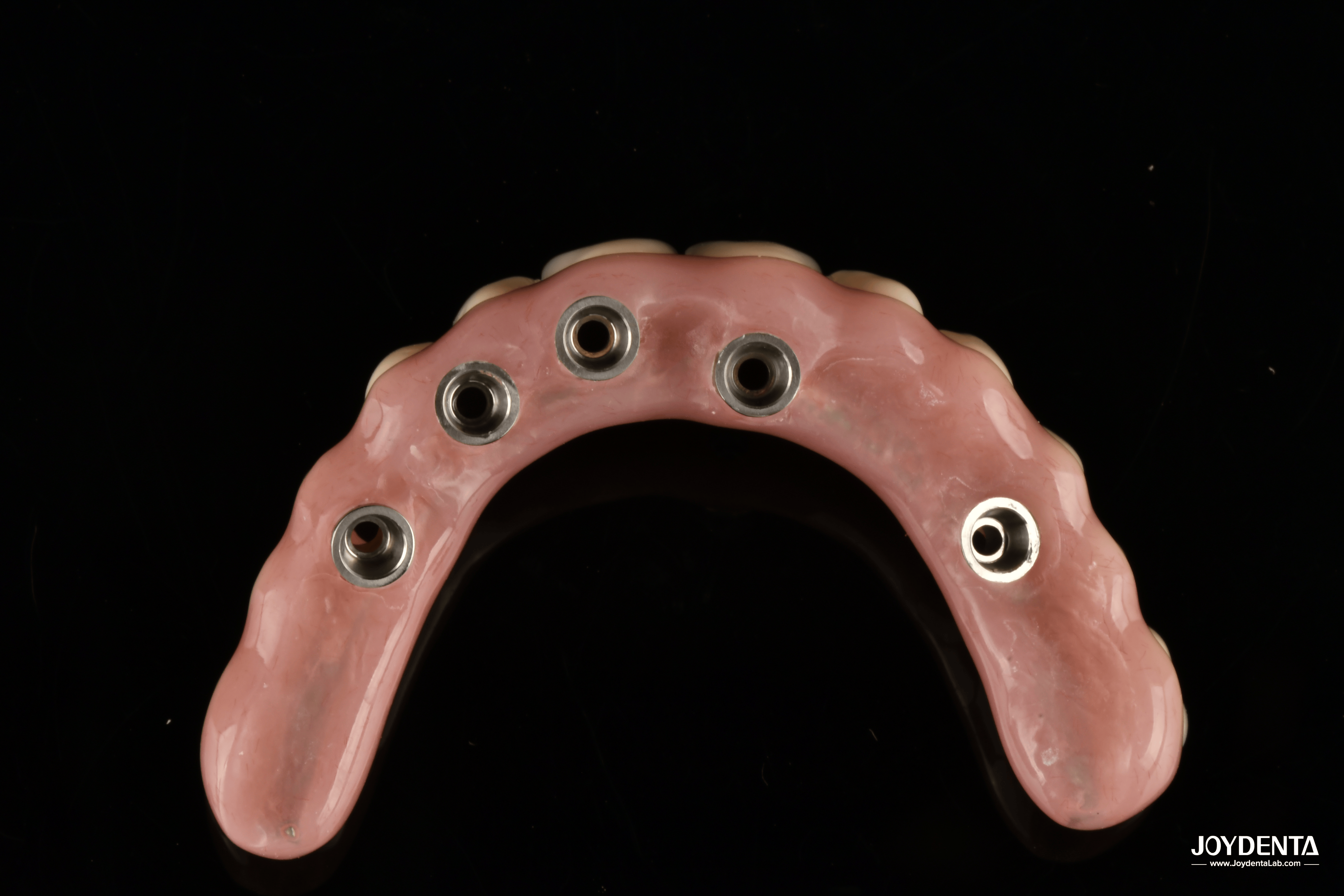 Quality Redefining Full Arch Prosthetics: Unmatched Fit and Function with Our Ti-Base for sale