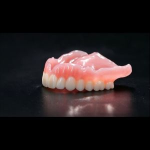 Quality Full Arch Overdenture Removable Prosthodontics for sale