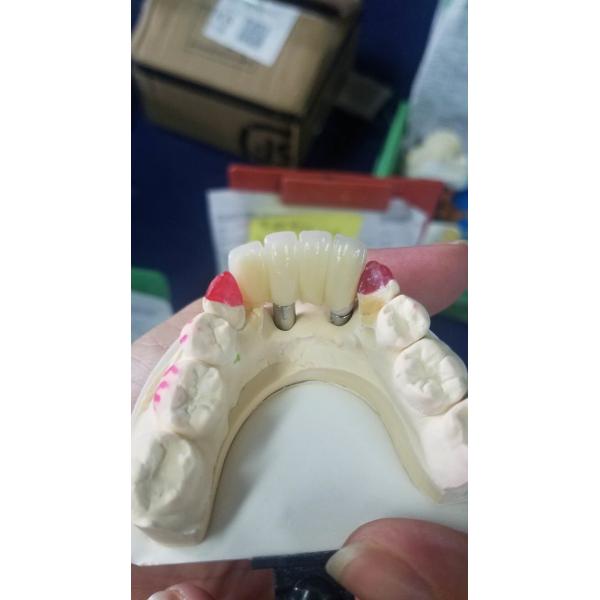 Quality Smooth Surface Biocompatible Zirconia Tooth Crown Easy Maintain for sale