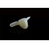 Quality Custom available Dental Resin-bonded Maryland bridge from Shenzhen ADS dental for sale