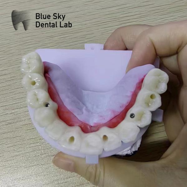 Quality Implant Cases with Sleek Surface for Optimal Surgical Outcomes for sale