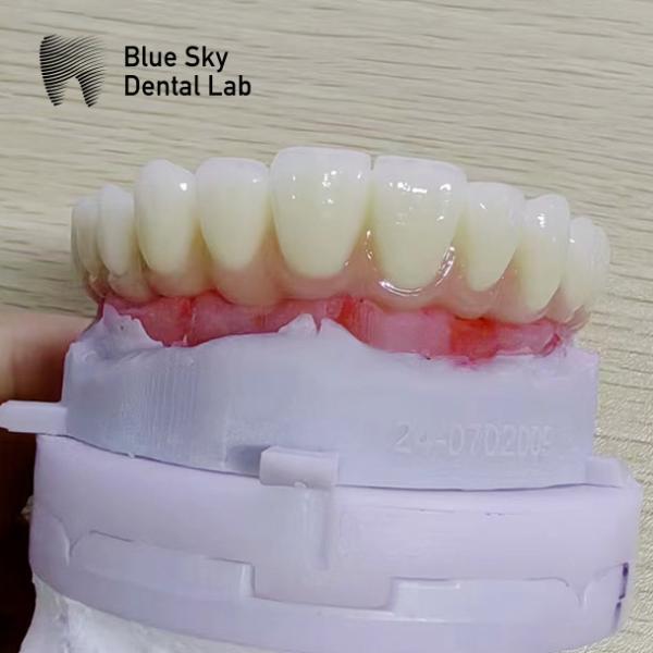 Quality Nature Implant Procedure Cases with Universal Compatibility and Optimal for sale
