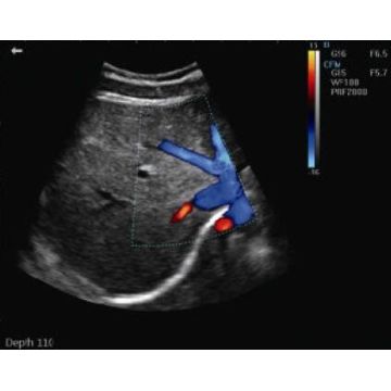 Quality Portable Pregnancy Ultrasound Scanner with Abdominal Convex Transvaginal for sale