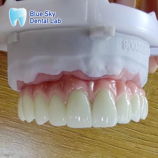 Quality Metal Frame Titanium Malo Bridge Customizable Malo Implant Bridge for sale