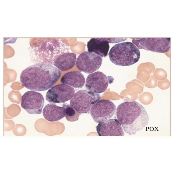 Quality Leukocyte Peroxidase (POX) Stain (Myeloperoxidase) for sale