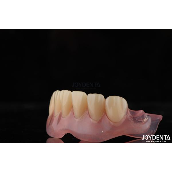 Quality Natural Looking Dental Complete Denture Odor Resistant Adjustable For Proper Fit for sale