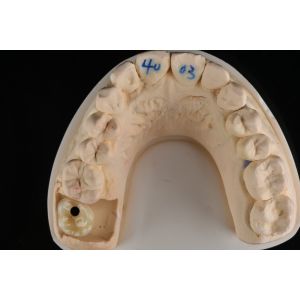 Quality Professional Grade Dental Zirconia Hybrid Imitation Material Smooth Or Rough for sale