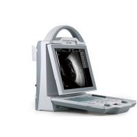 Quality Portable Sonogram Machine Portable Ultrasound Scanner with Multi-frequency Probes for sale