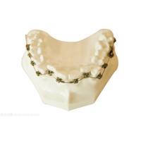 Quality Dental Brackets Orthodontics Fixed Tooth Modeling Tools Dental Braces for sale