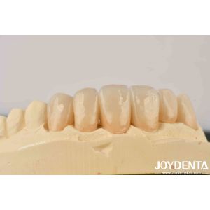 Quality Let The Light Dance In Zirconia Building The Transparency Of Enamel And The for sale