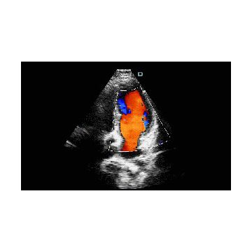 Quality Medical Handheld Ultrasound Doppler Scan Machine With Cardiac Transducer for sale