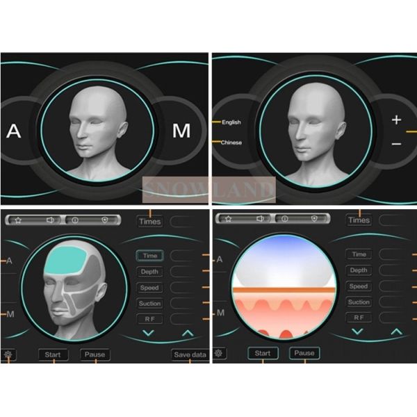 Quality Semicondoctor 808nm Laser Diode Laser Hair Removal Machine With Skin Contact Sensor Ensuring Fast Hair Removal Treatment for sale