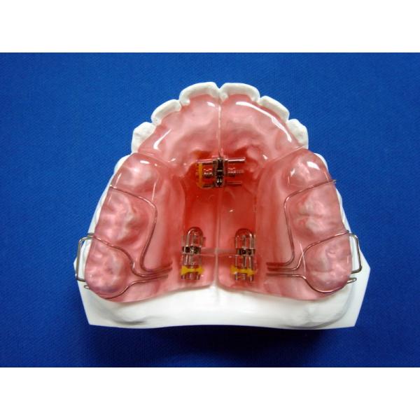 Quality High Hardness FDA Functional Appliance Orthodontic Rubber Retainer for sale