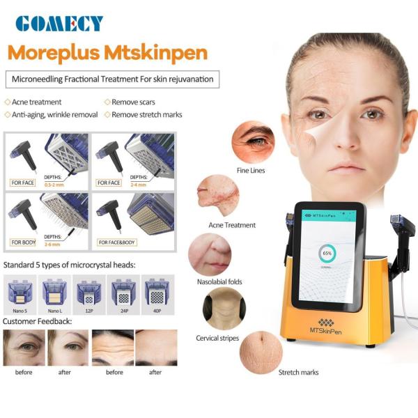 Quality Gold Fractional Rf Microneedling Machine Beauty Microneedle Rf Lifting Machine for sale