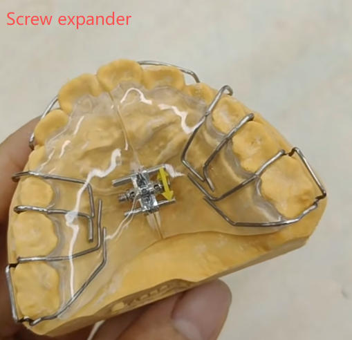 Quality Biocompatible and Clinically Proven Dental Expander - Custom-fitted Maxillary for sale