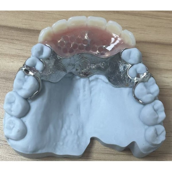Quality Metal Framework with acrylic partial denture finish for sale
