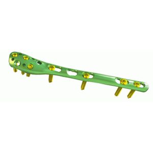 Quality Orthopedics Distal Fibula Locking Plate Trauma Fixation Devices for sale