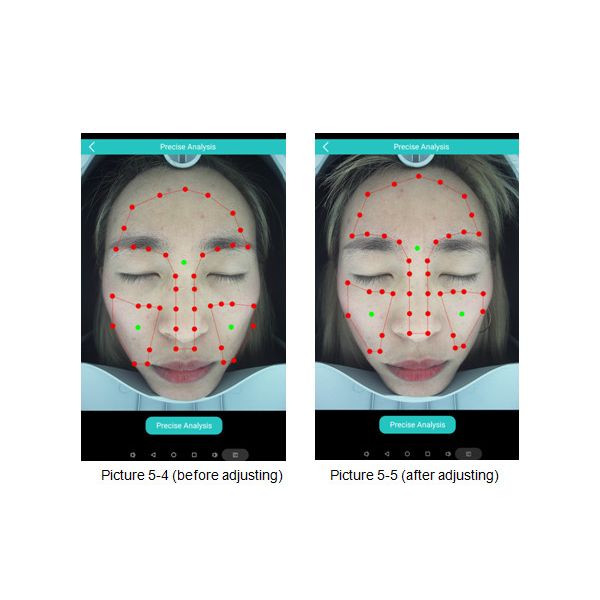 Quality Medical 3D Skin Analyzer Digital Facial Analysis System CE Certified for sale