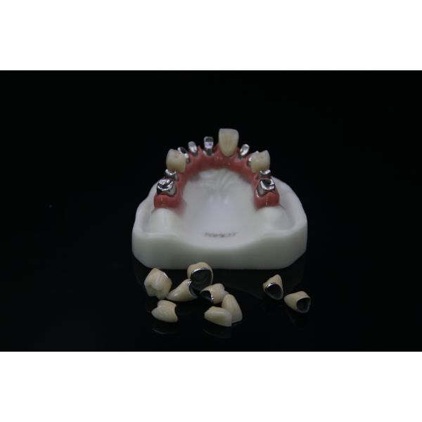 Quality Porcelain Dental Crown Tooth-Shaped Cap for Restoring Shape and Enhancing for sale