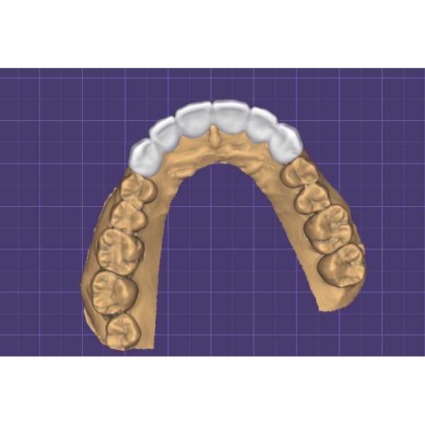 Quality Precision Fit Digital Wax Up Dental Study Model with Durable and Biocompatible for sale