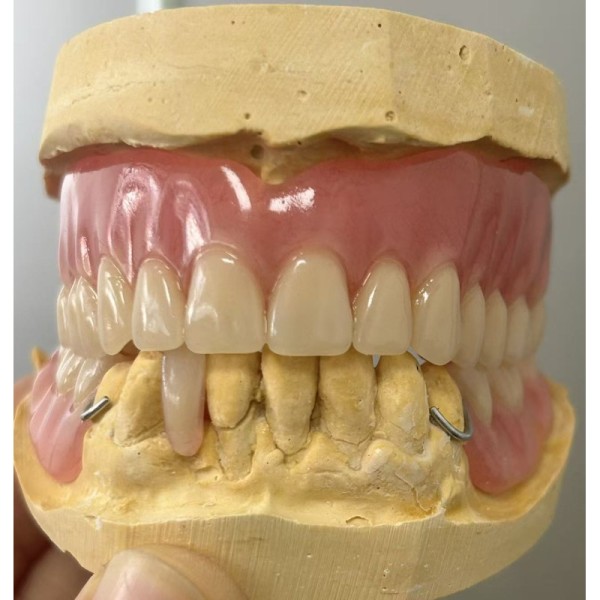 Quality Full Arch Denture for sale