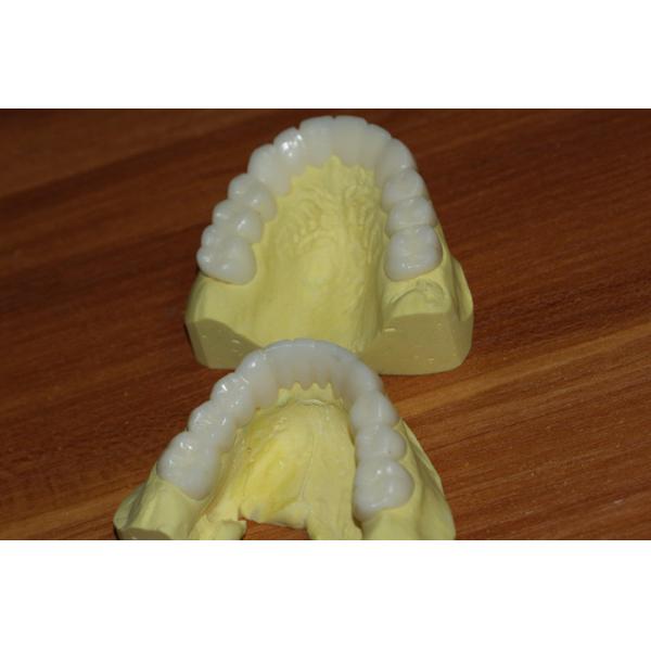 Quality Temporary PFM Dental Crown for sale