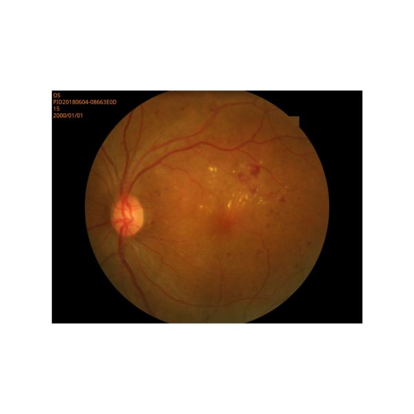 Quality SYSEYE RetiCam 3100 Digital Fundus Camera with 1.3 Magnification 26.5Kg Weight for sale