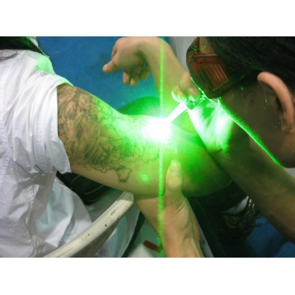Quality Dermatology Neodymium picolaser Nd Yag Laser 1064nm Portable for sale