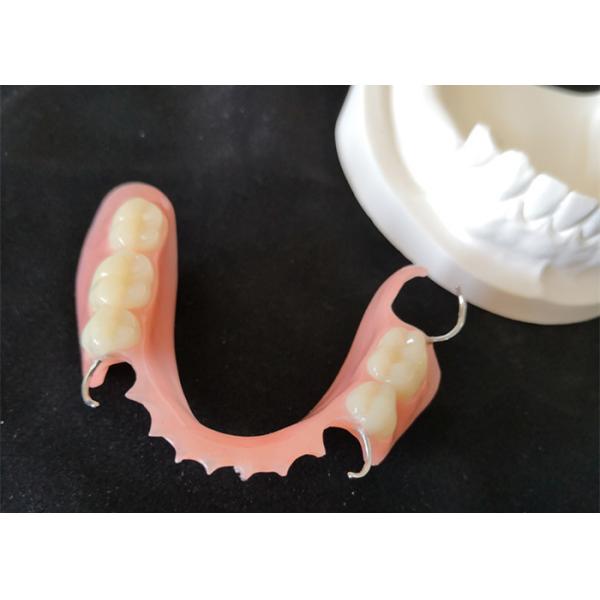 Quality High Definition PFM Bridge Dental Colour Stability Smooth Surface for sale