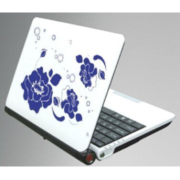 Quality Mobile Ultrasound Machine Digital Laptop Ultrasound Scanner with 100 Frames for sale