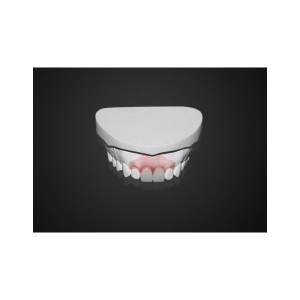 Quality Lightweight Comfortable Valplast Partial Denture Easy Cleaning High Transparency for sale