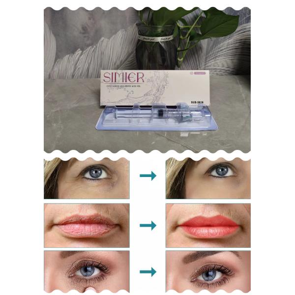 Quality Good Quality Feamle Beauty Products Medical Anti-Aging Derm Dermal Filler 2 Ml for sale