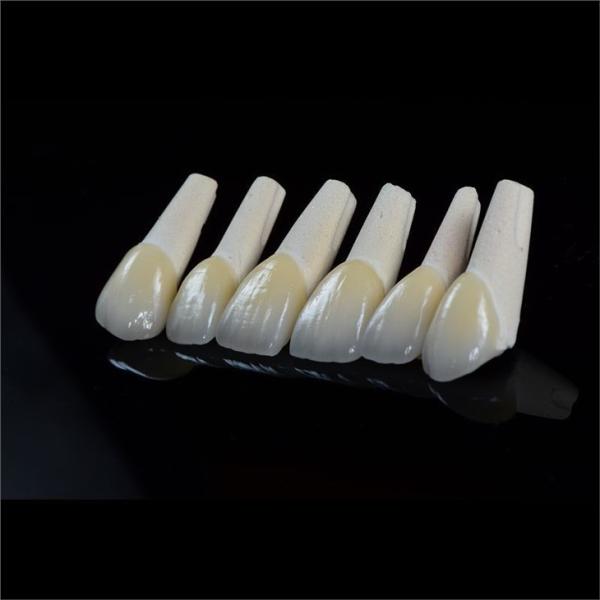 Quality Dental Lab Teeth Feldspathic Porcelain Veneers Custom Shaped for sale