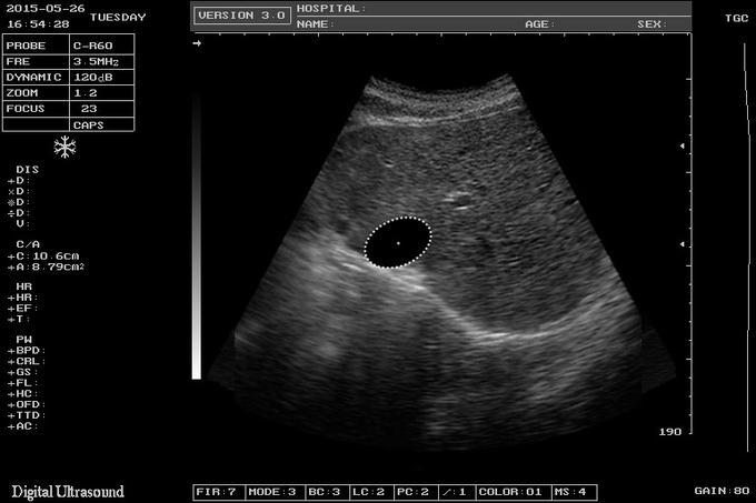 SRA Large Animal Veterinary Ultrasound Machine 64G 12 Inch LCD Display 8