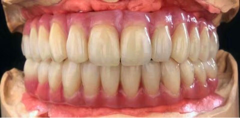 Quality Zirconia All-Ceramic Teeth Crowns & Bridges for sale