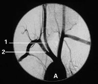 Quality Konida Medical X Ray Films for sale