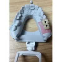 Quality Full Zirconia Screw Retained Abutment for Implant Supported Dental Restoration for sale