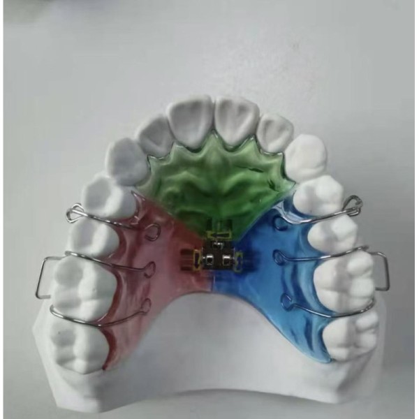 Quality Biocompatible and Clinically Proven Dental Expander - Custom-fitted Maxillary Expander for Palatal Expansion for sale