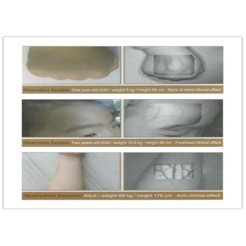 Quality 800 * 1280 Resolution Untouched Vein Locator Device 850nm Wavelength High for sale