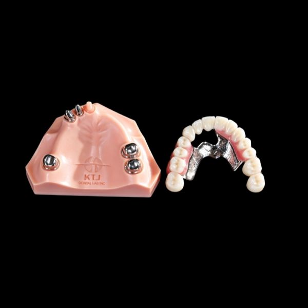 Quality Telescope Metal Crown And Bridge For Dental And Orthodontic for sale