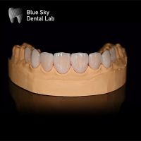 Quality Lightweight Rectangular Dental Veneer Cases With Passive Fitting Only 0.3mm for sale