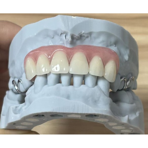 Quality Metal Framework with acrylic partial denture finish for sale