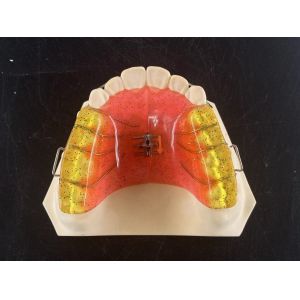 Quality Customized 2 Ways Dental Arch Expander Adjustable Orthodontic Appliance for sale
