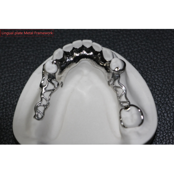 Quality Titanium Alloy Metal Framework for Removable Dentures - Lightweight and High for sale